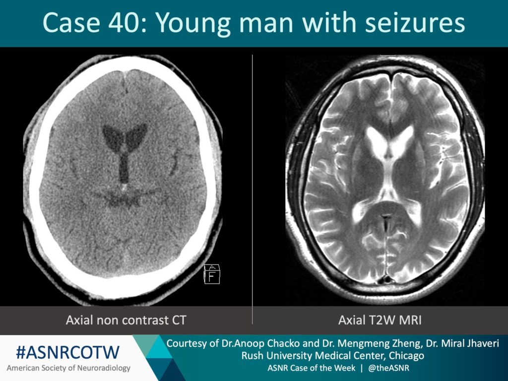 ASNR Case of the Week: Case #40 - American Society of Neuroradiology