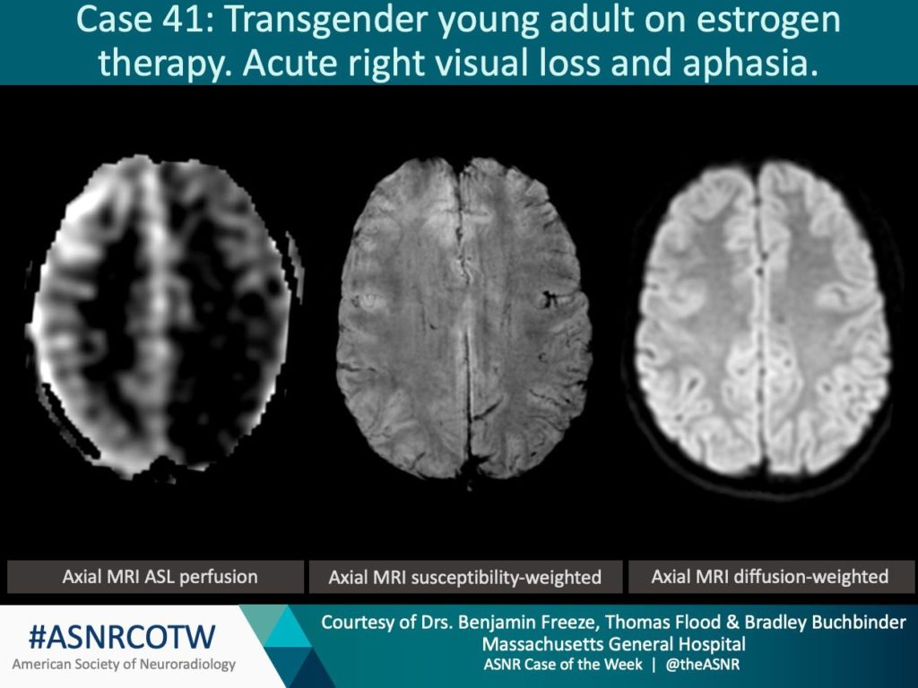 ASNR Case of the Week: Case #41 - American Society of Neuroradiology
