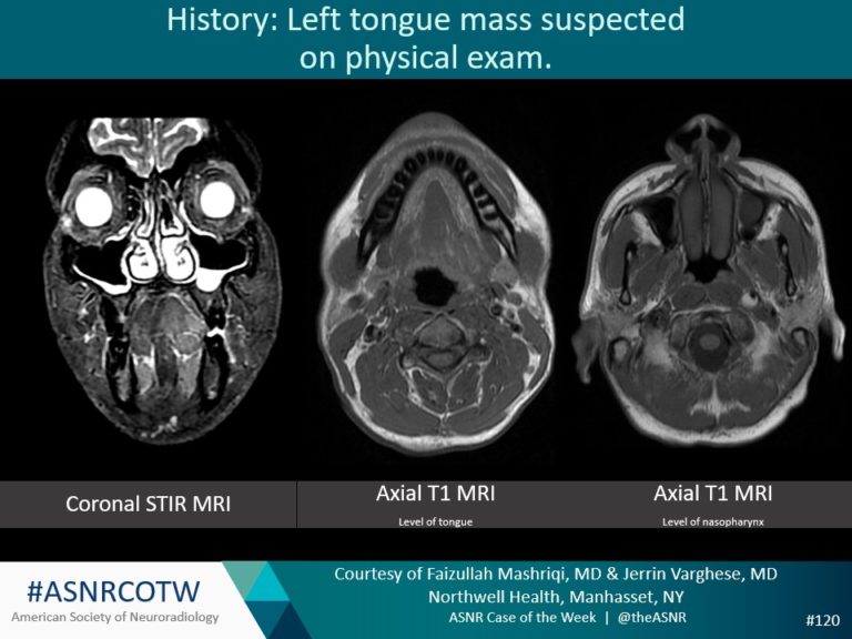 ASNR Case of the Week: Case #120 - American Society of Neuroradiology