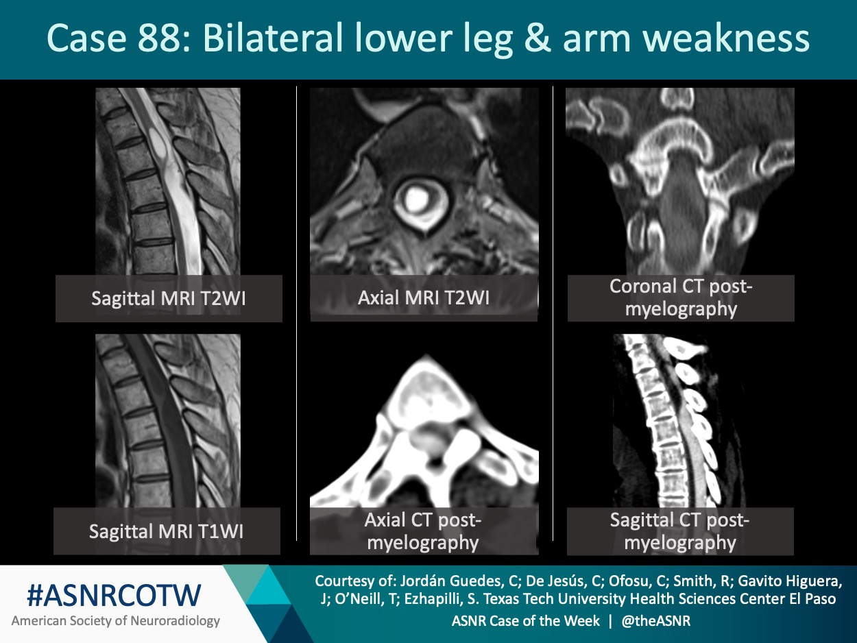 ASNR Case of the Week: Case #88 - American Society of Neuroradiology