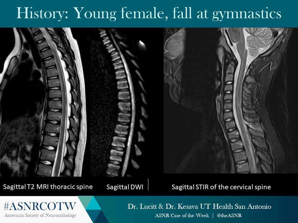 Case of the Week - American Society of Neuroradiology